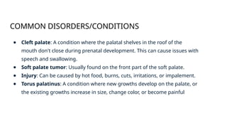 Seminar on Hard&Soft Palate anatomy.pptx
