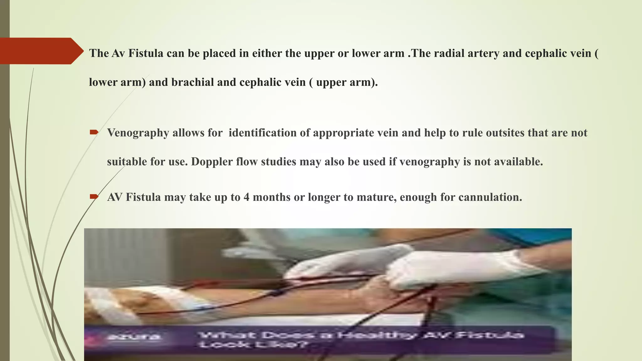 Hemodialysis | PPTX
