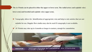 Hemodialysis | PPTX