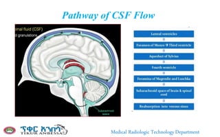 Seminar on hydrocephalus | PPT
