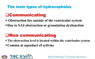 Seminar on hydrocephalus | PPTX