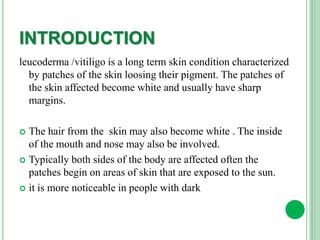 Seminar on lecoderma | PPTX