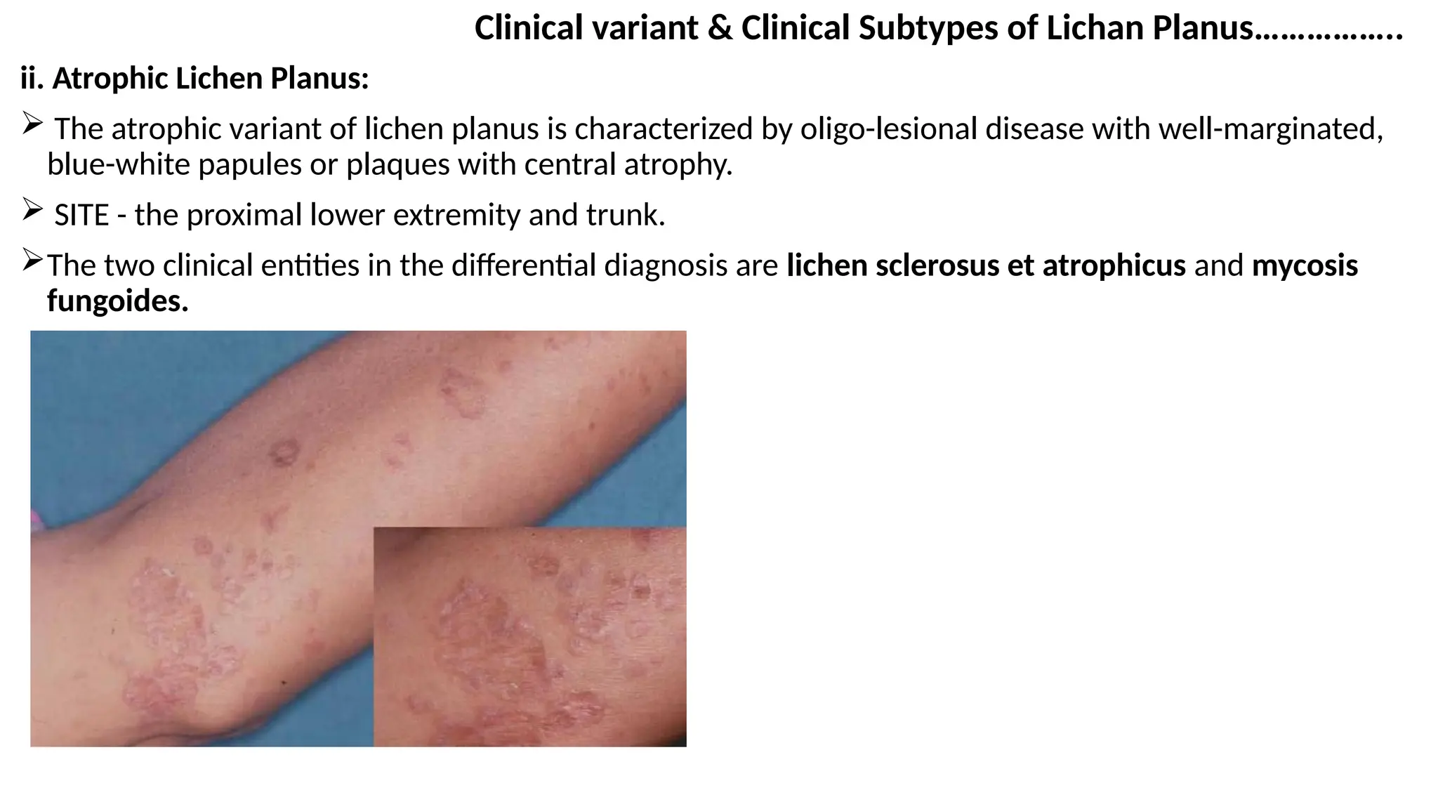 Seminar_on_Lichen_Planus Dr RAMAWATAR (2).pptx