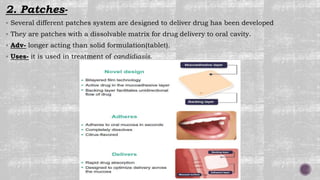 Seminar on mucosal drug delivery system. | PPTX | Dental Health ...