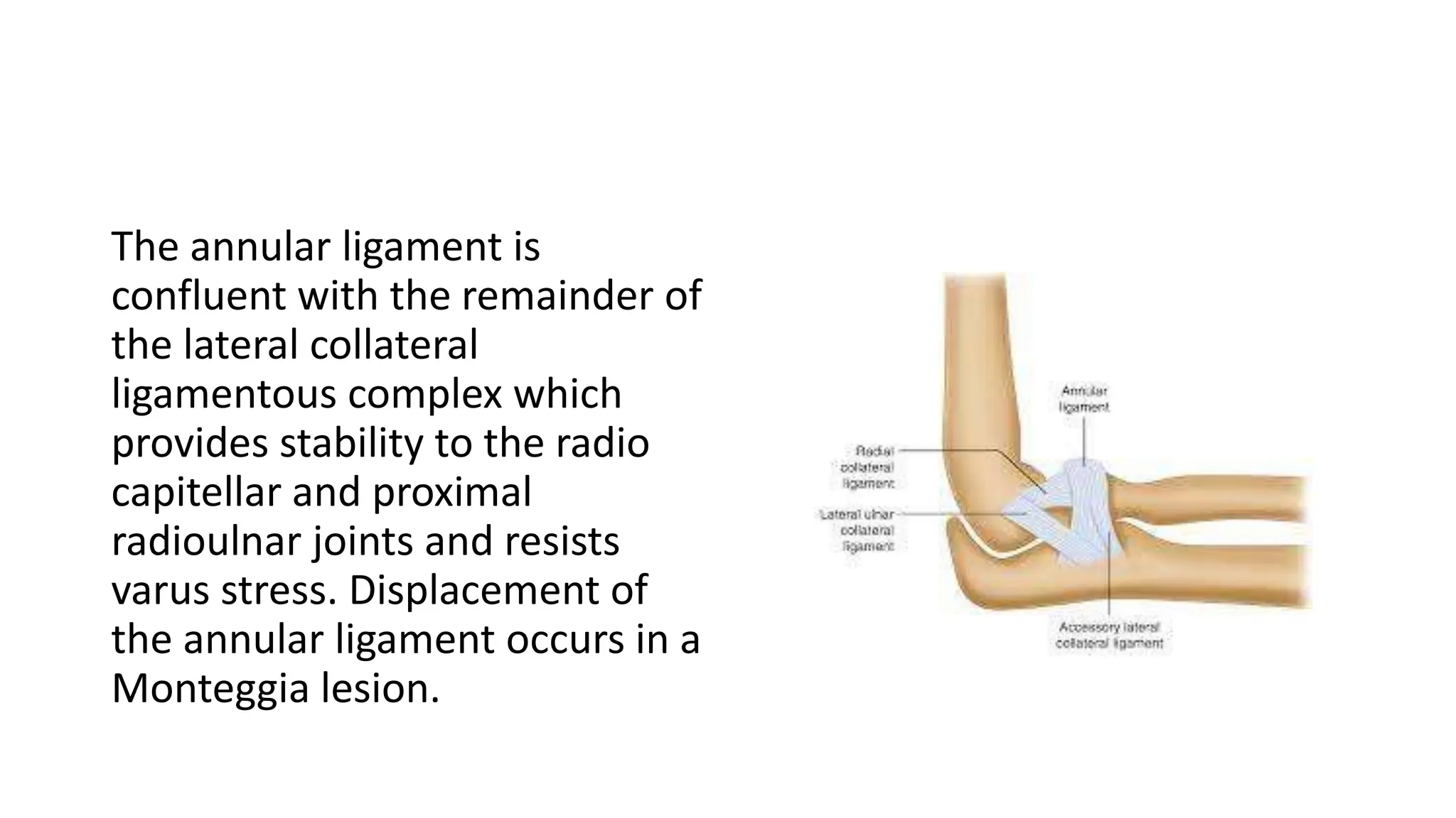 Seminar on monteggia fracture AND TYPES.pptx