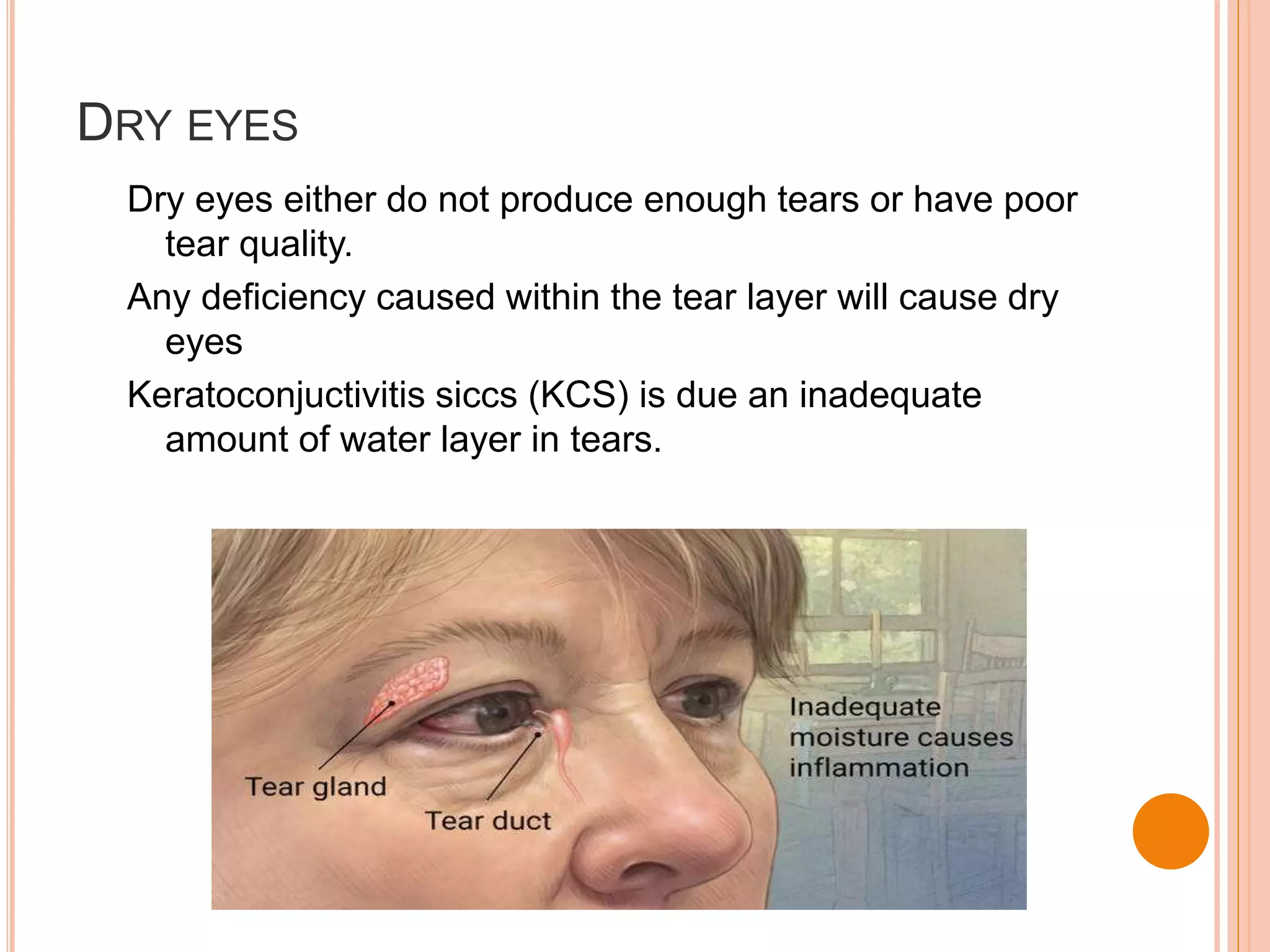 Seminar on Ophthalmic Disorders | PPTX