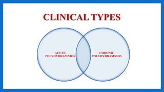 Polyhydramnios | PPTX