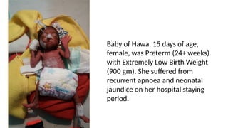 Seminar on preterm baby or prematuirity (paediatrics) | PPTX