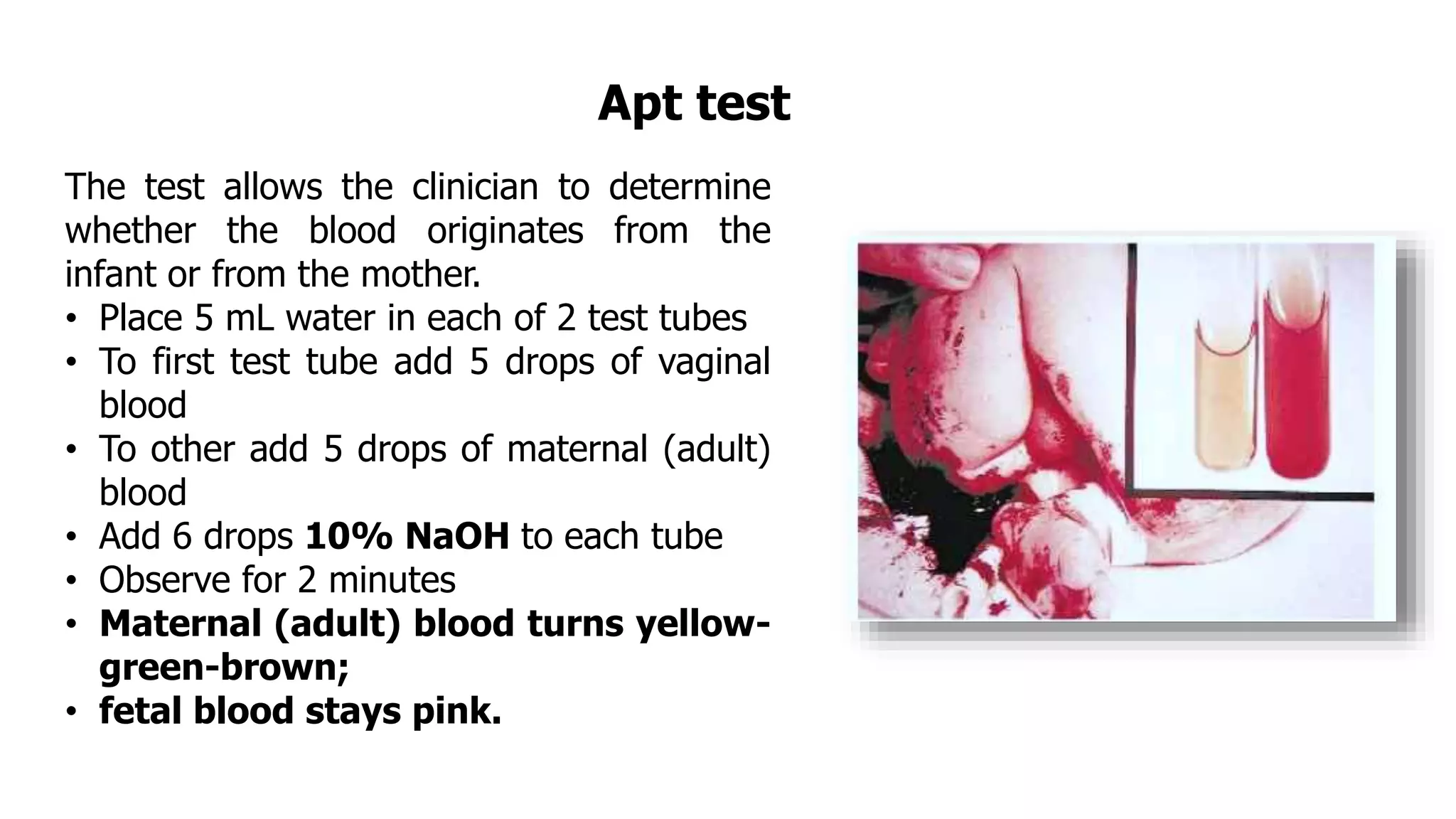 Seminar on pulmonary hemorrhage in newborn by Dr. Habib, Dr. Ashfaq | PPTX