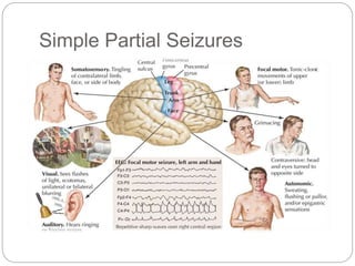 Seminar on Seizure Disorders | PPTX