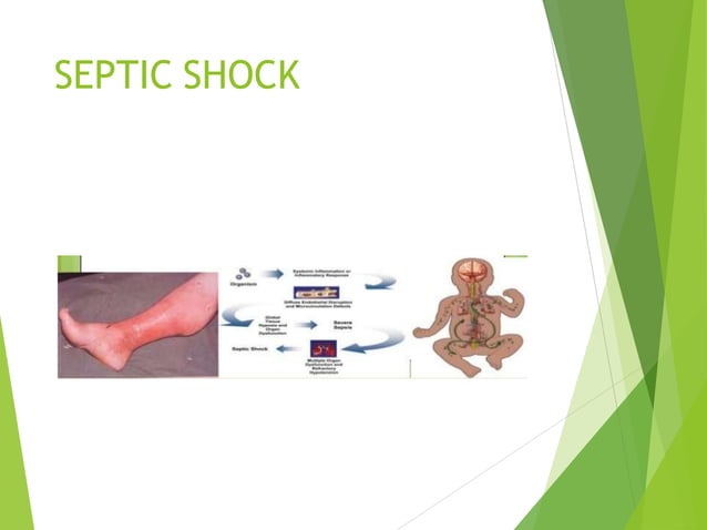 MANAGEMENT OF SHOCK | PPTX | Heart and Cardiovascular Diseases ...