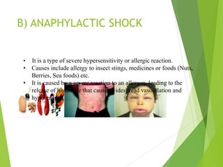 MANAGEMENT OF SHOCK | PPTX