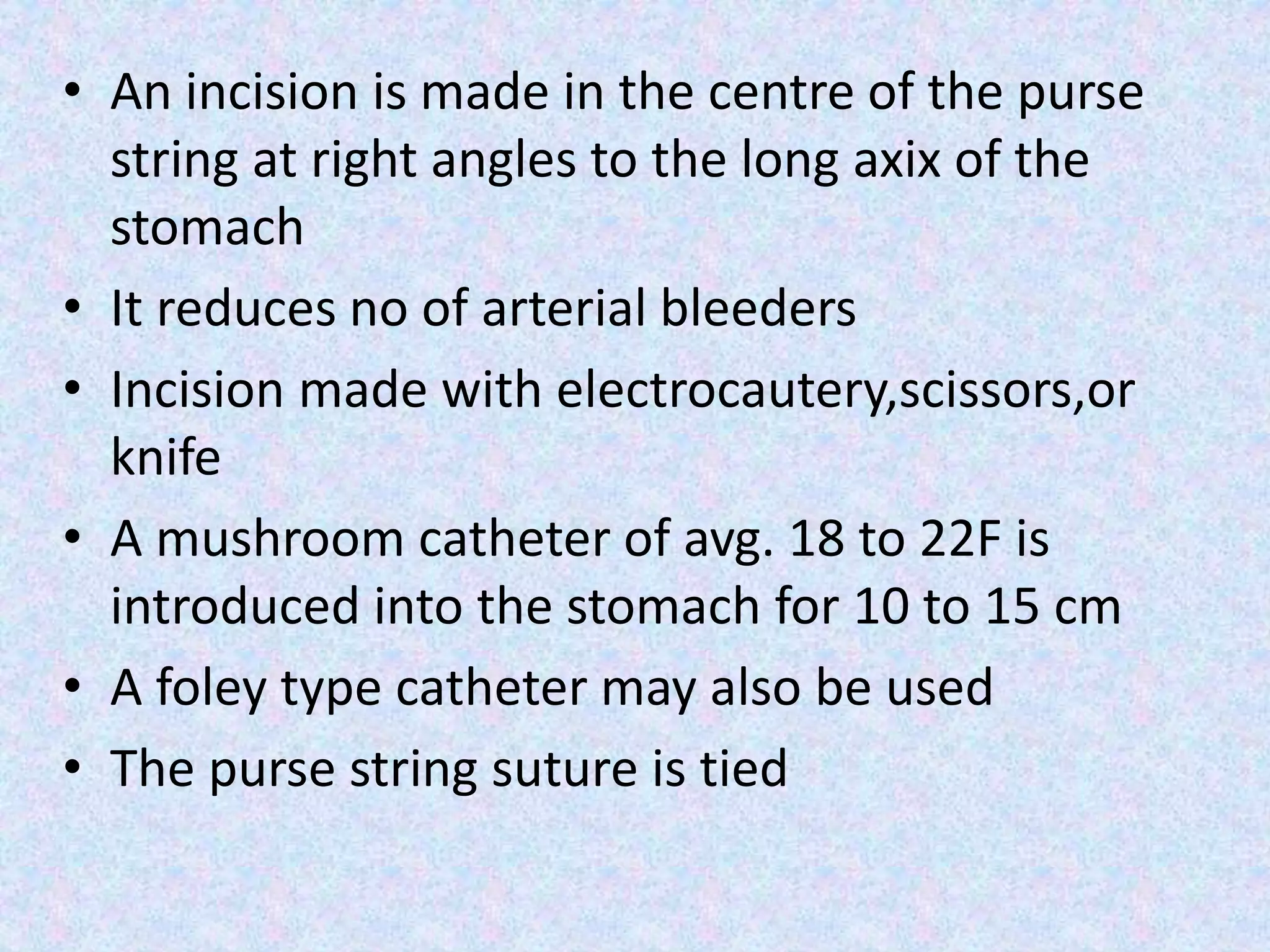 Seminar on stamm, janeway & PE gastrostomy | PPTX