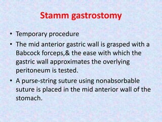 Seminar on stamm, janeway & PE gastrostomy | PPTX