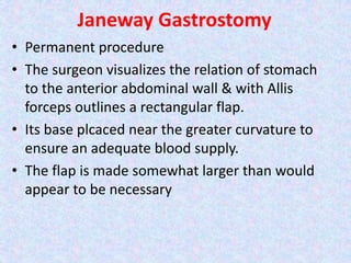 Seminar on stamm, janeway & PE gastrostomy | PPTX
