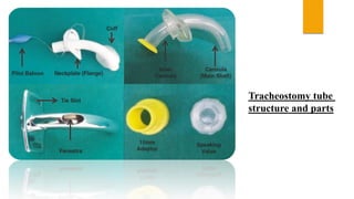 Seminar on Tracheostomy, types and its Complications. | PDF
