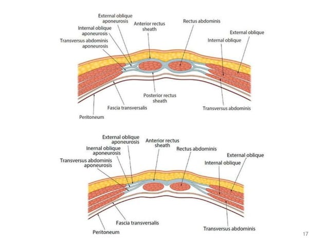 Truncal blocks.pptx