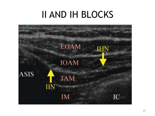 Truncal blocks.pptx