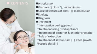Management OF class ||| malocclusion | PPT