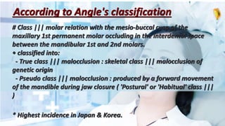 Management OF class ||| malocclusion | PPT