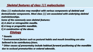 Management OF class ||| malocclusion | PPTX