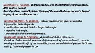Management OF class ||| malocclusion | PPT