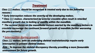Management OF class ||| malocclusion | PPT