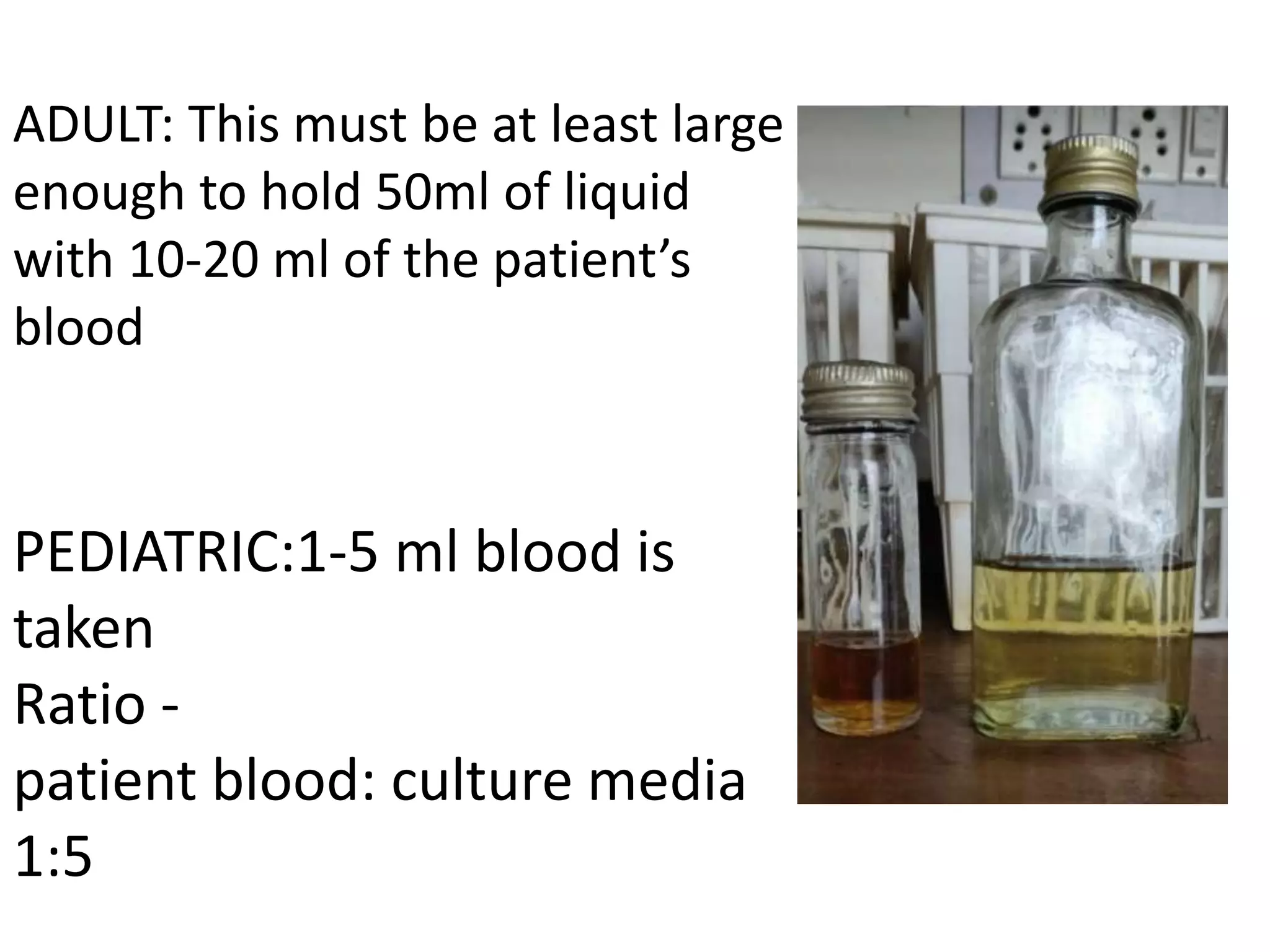 samplecollection and transport of sample | PPTX