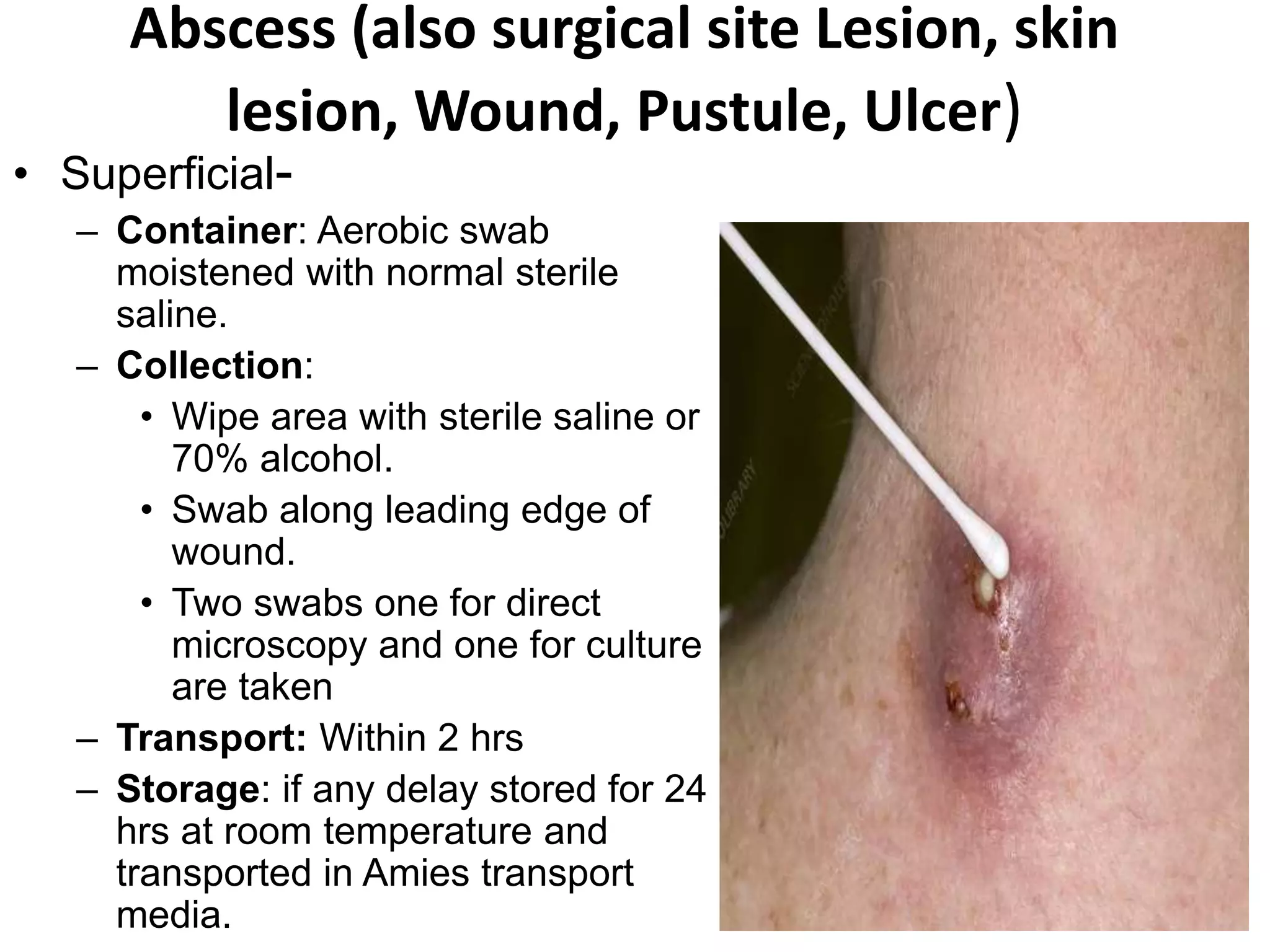 samplecollection and transport of sample | PPTX