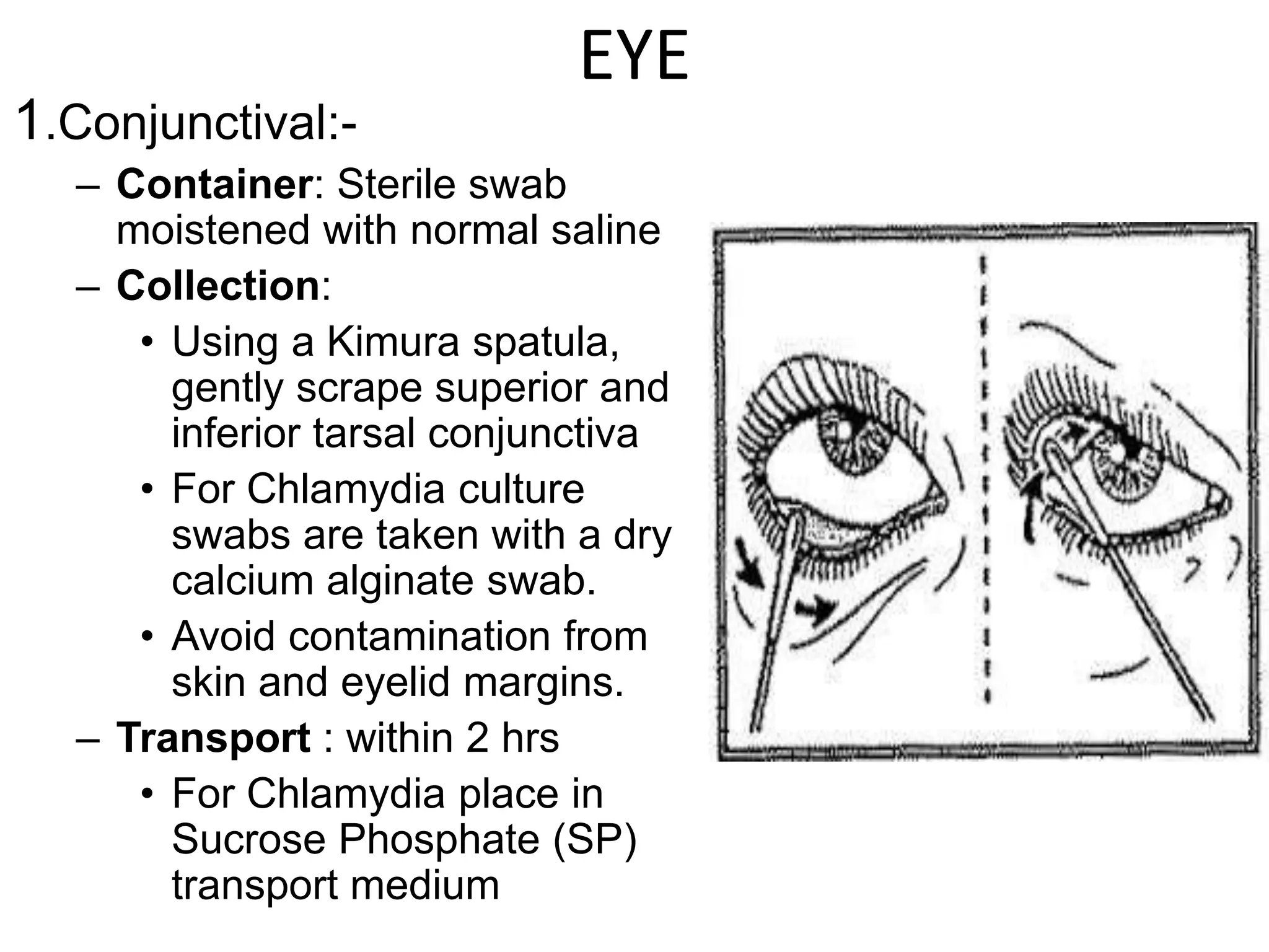 samplecollection and transport of sample | PPTX