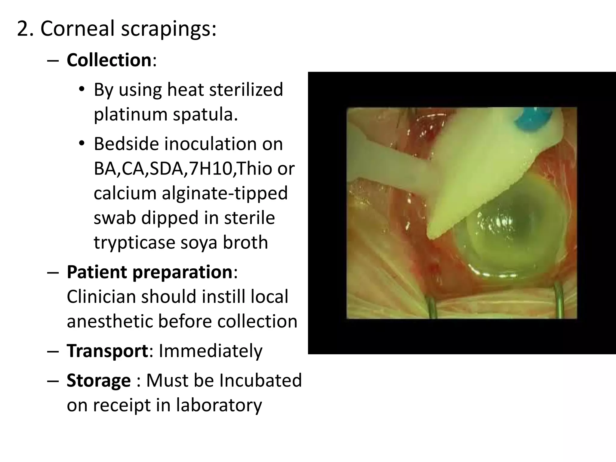 samplecollection and transport of sample | PPTX