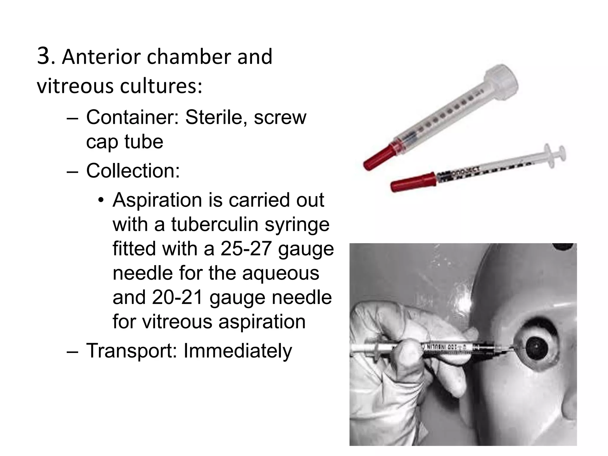 samplecollection and transport of sample | PPTX