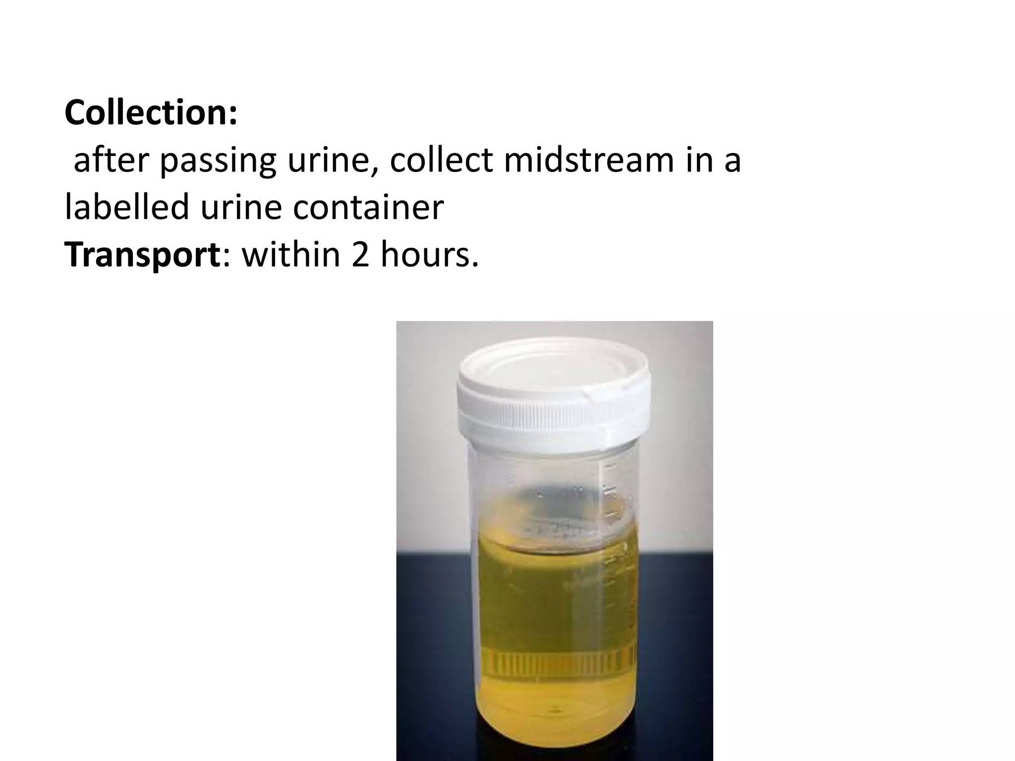 samplecollection and transport of sample | PPTX