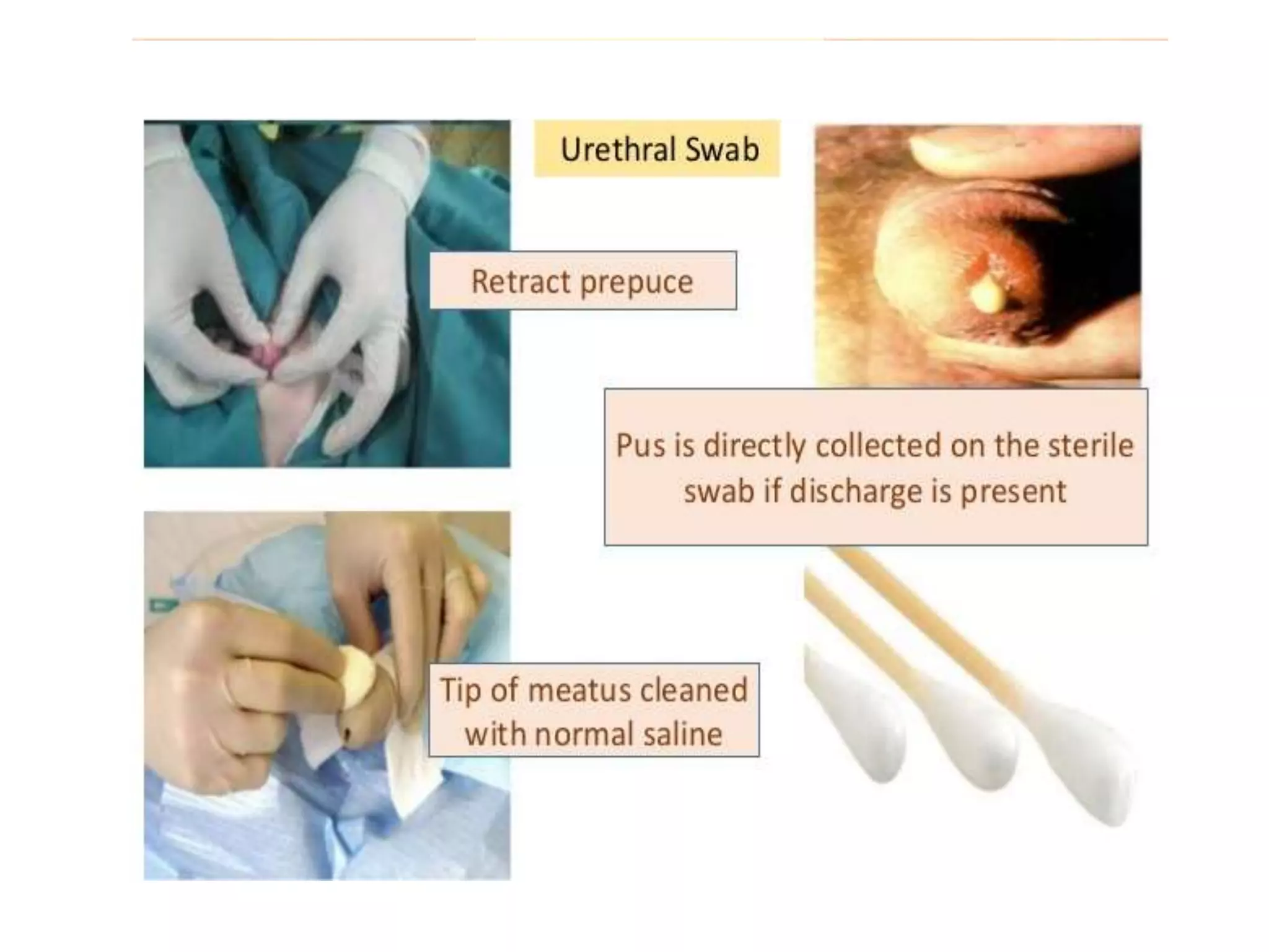 samplecollection and transport of sample | PPTX
