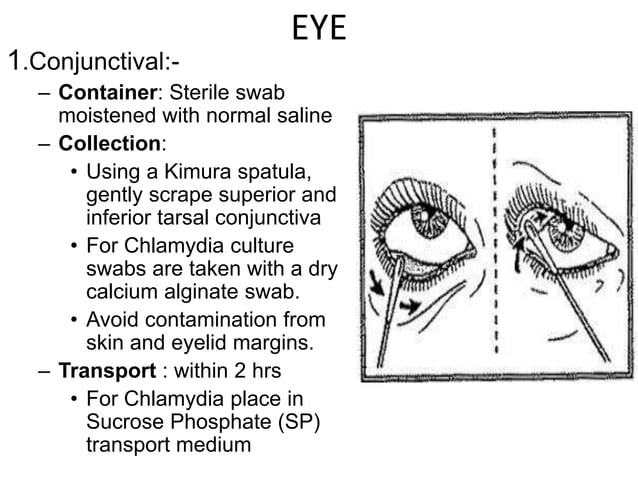 samplecollection and transport of sample | PPTX