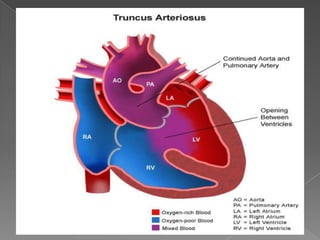 Seminar congenital cardiac disorders (pda,TA and AP Window) | PPT