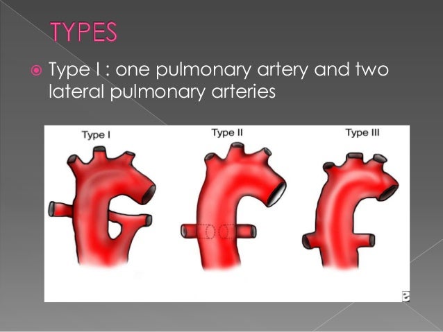 Seminar congenital cardiac disorders (pda,TA and AP Window)
