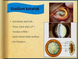 Skrinning & Penatalaksanaan Paska Operasi Katarak | PPTX