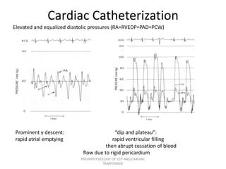 Pathophysiology of ccp and cardiac tamponade | PPTX