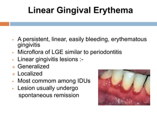 Linear Gingival Erythema