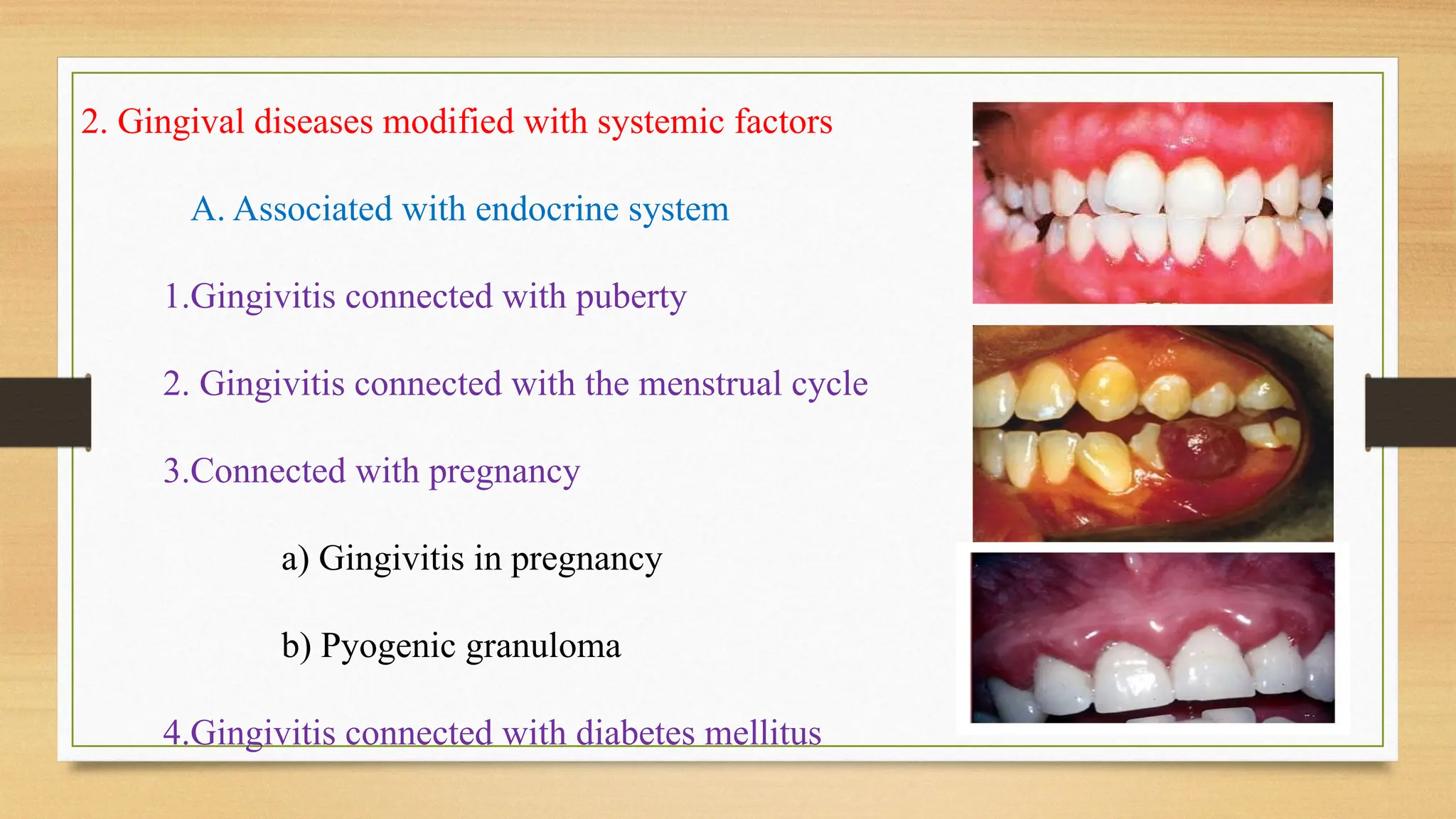 Periodontal diseases classification.pptx | Dental Health | Diseases and ...