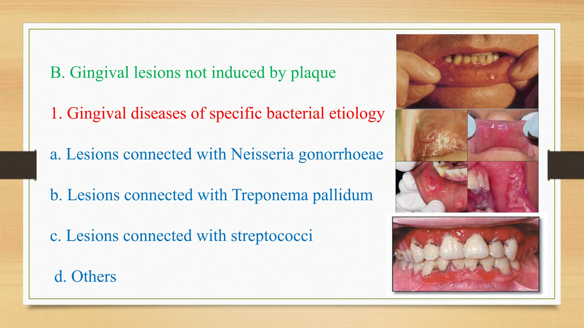 Periodontal diseases classification.pptx | Dental Health | Diseases and ...