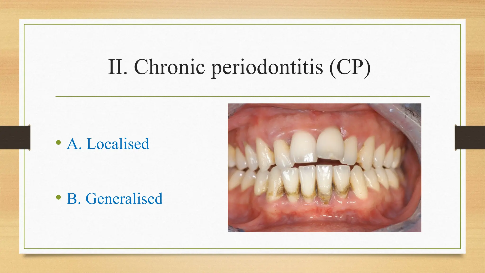 Periodontal diseases classification.pptx | Dental Health | Diseases and ...