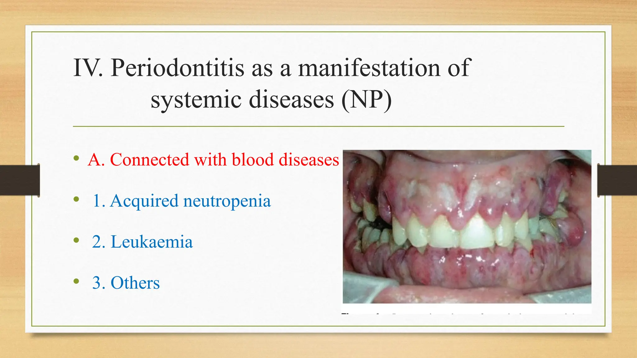 Periodontal diseases classification.pptx | Dental Health | Diseases and ...