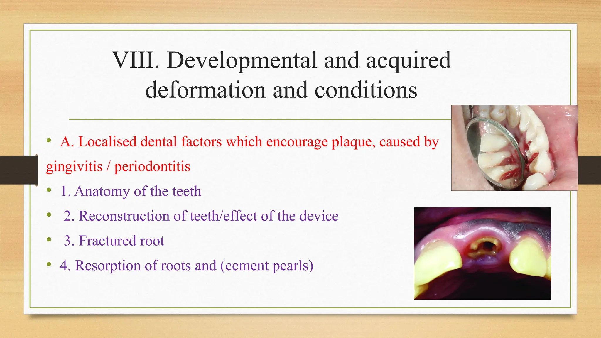 Periodontal diseases classification.pptx | Dental Health | Diseases and ...