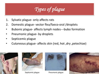 PLAGUE | PPTX