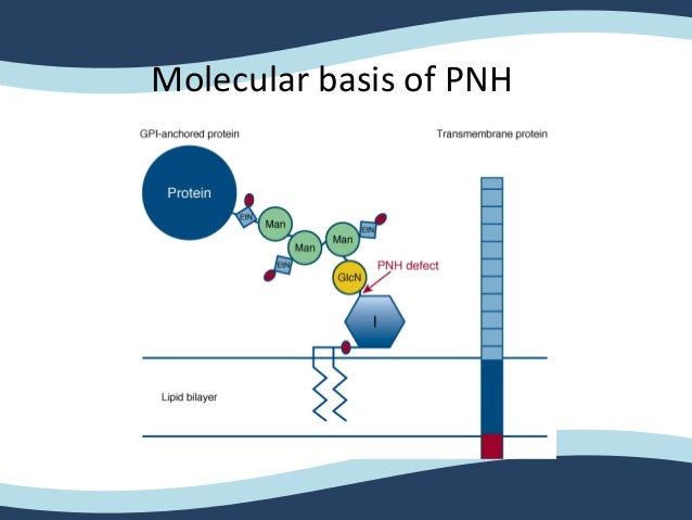 Paroxysmal nocturnal hematuria
