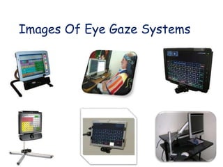 EYE GAZE SYSTEM | PPTX