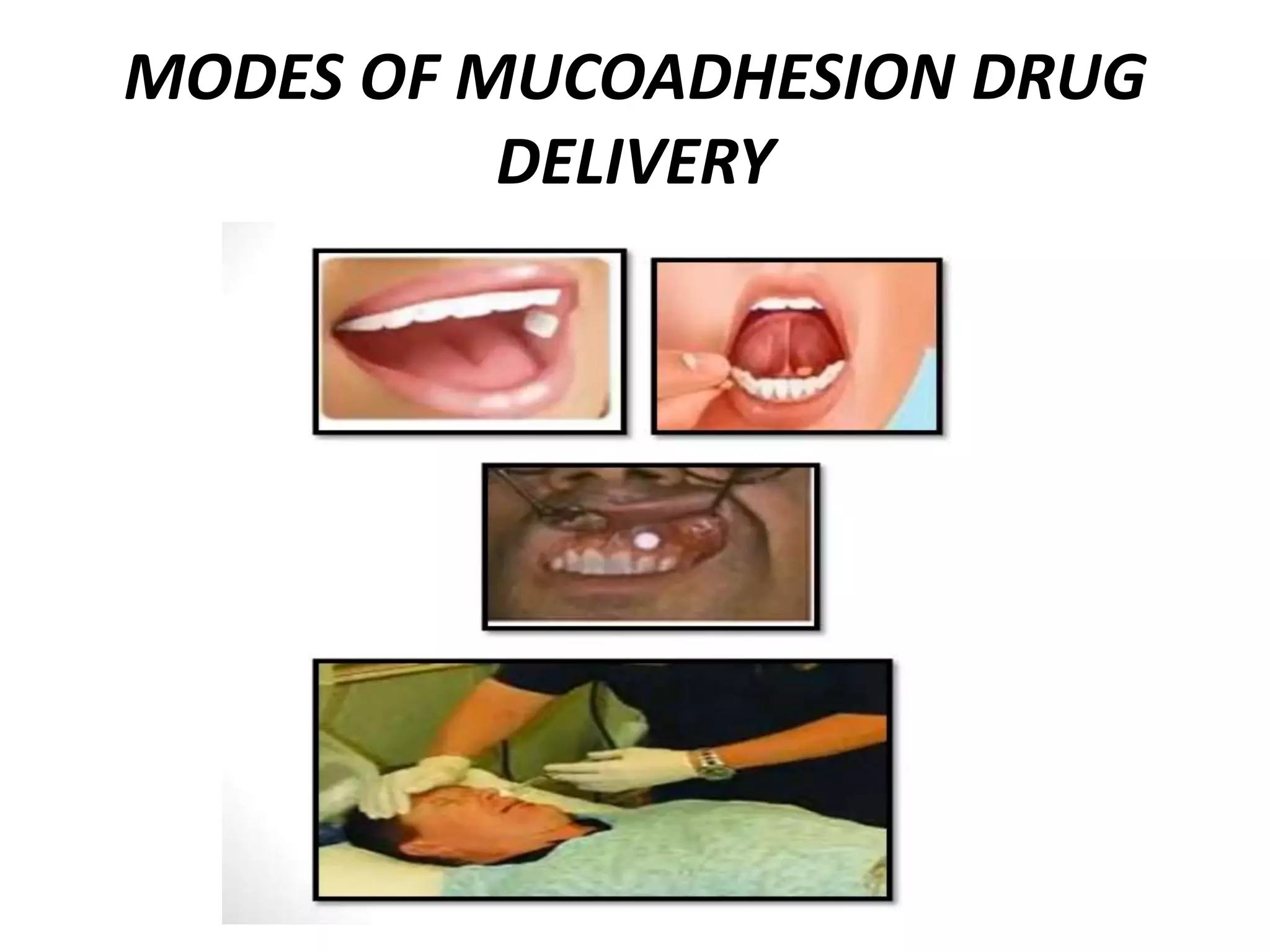 ADHESIVE DRUG DELIVERY SYSTEMS | PPT