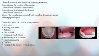 Complete denture and denture material Seminar | PPT